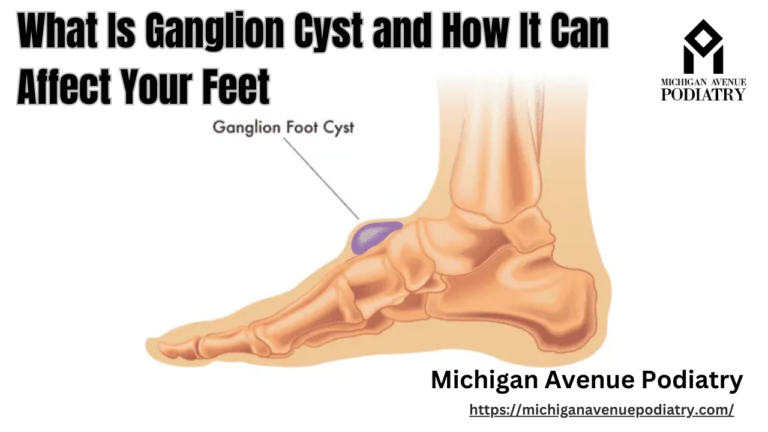Ganglion Cyst On Foot: Causes, Symptoms & Treatment