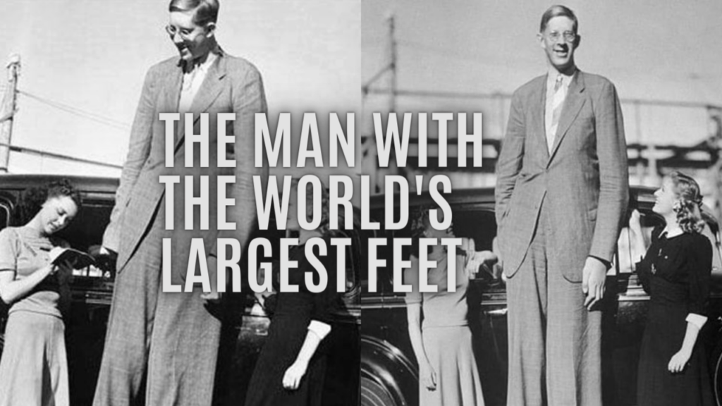 Worlds Biggest Feet At 16 This Teen Makes World Record For Having Worlds Biggest Feet At 16 This Teen Makes World Record For Having