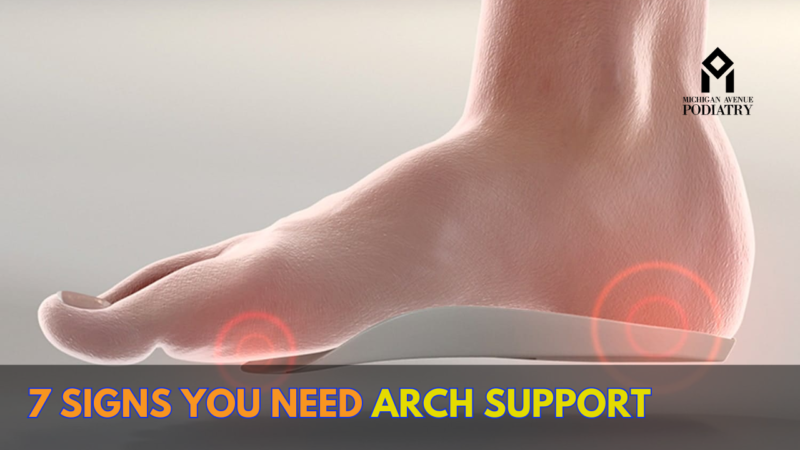 7 Warning Signs You Need Arch Support — Podiatrist Guide