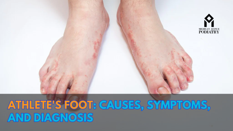 Athlete's Foot: Causes, Symptoms, And Diagnosis