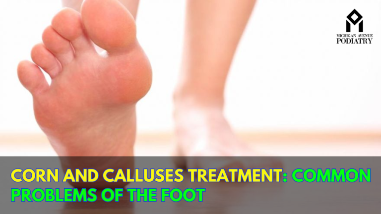 Corn And Calluses Treatment: Common Problems Of The Foot