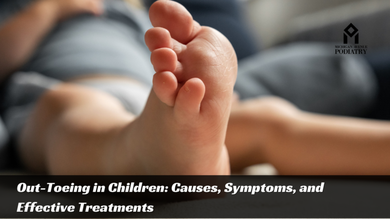 Out-Toeing In Children: Causes, Symptoms, And Effective Treatments