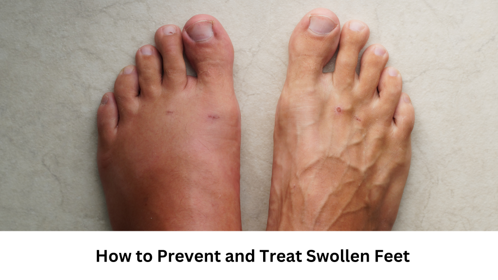 Reduce Swelling In Feet Six Tips To Get Rid Of Swollen Feet And Ankles