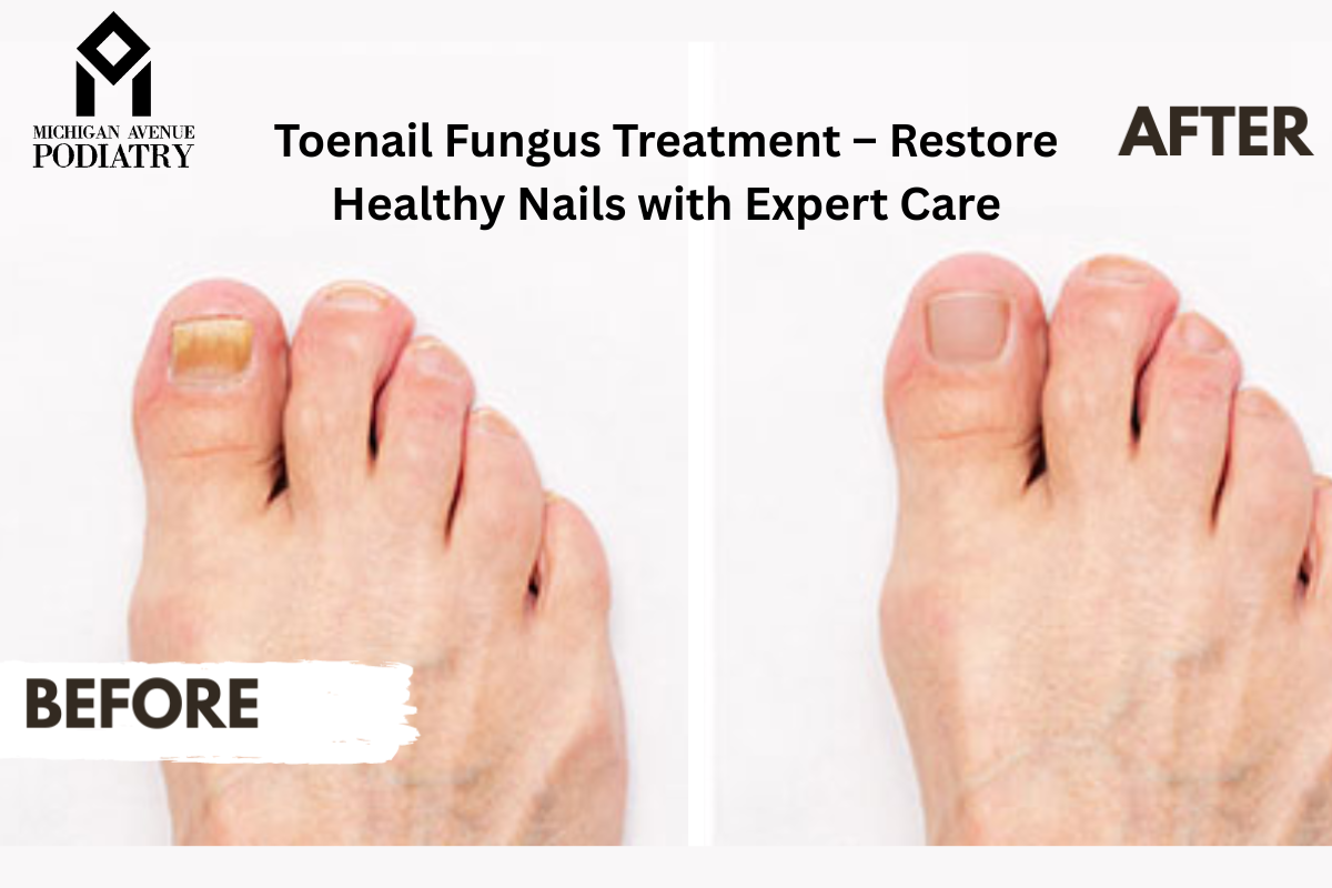 Toenail Fungus Treatment In Chicago, IL