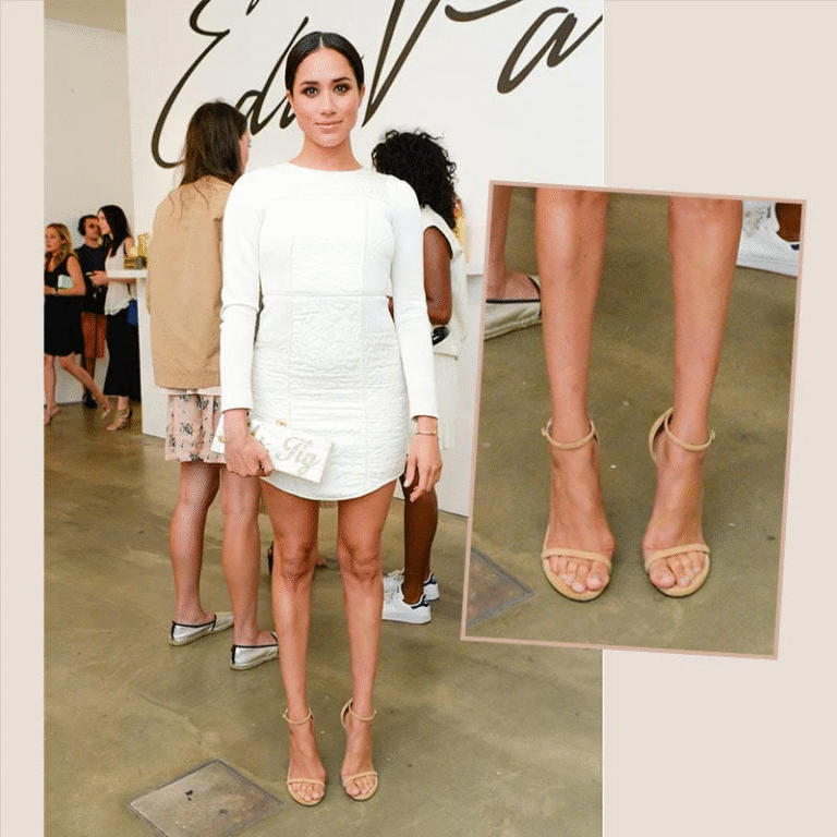 10 Celebrities With Bunions: Famous Feet & What They Did About It