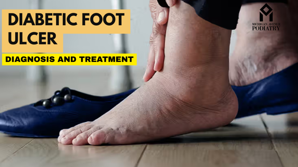 Diabetic Foot Ulcer Treatment In Chicago | Expert Care