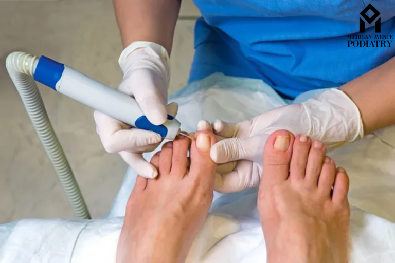 Infected Ingrown Toenail: Signs, Treatment & When To Worry